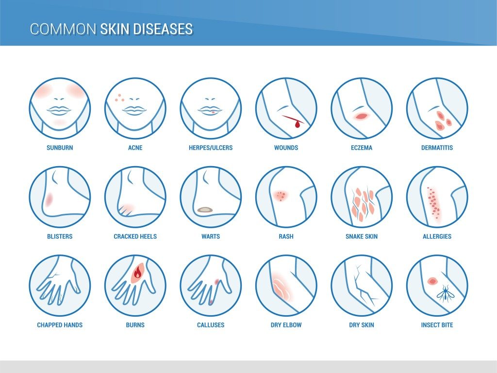 Mudras For Skin Disorders Learn Self Healing Techniques Online