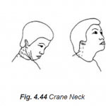 Neck Massage – Learn Self Healing Techniques Online